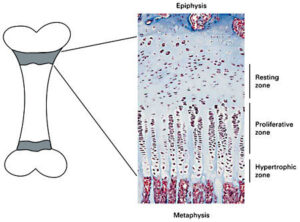Growth Plates: What They Are, When They Close, and Do They Reopen ...