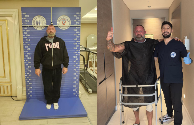 Limb Lengthening Surgery Before and After Patient Gallery - Wanna Be Taller